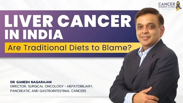 Causes of Liver Cancer: Hepatitis, Fatty Liver & NASH - Cancer Surgery ...