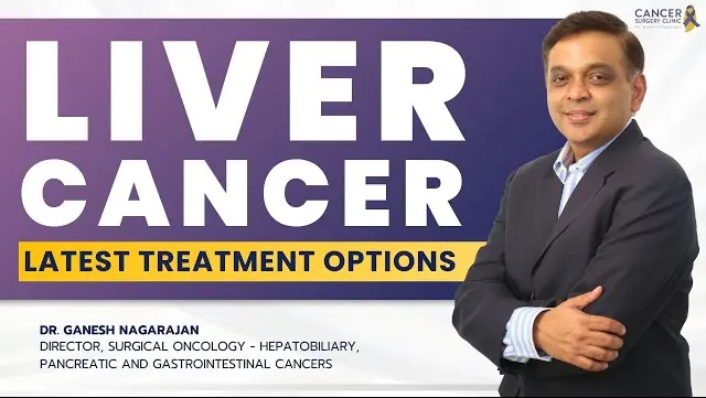 HCC Liver Cancer Treatments - Liver Resection - Cancer Surgery Clinic